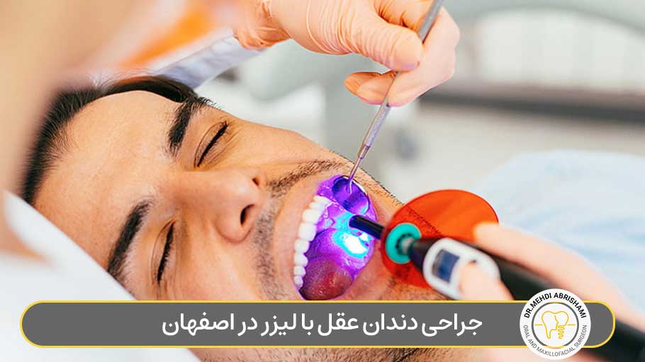 جراحی دندان عقل با لیزر در اصفهان - دکتر مهدی ابریشمی